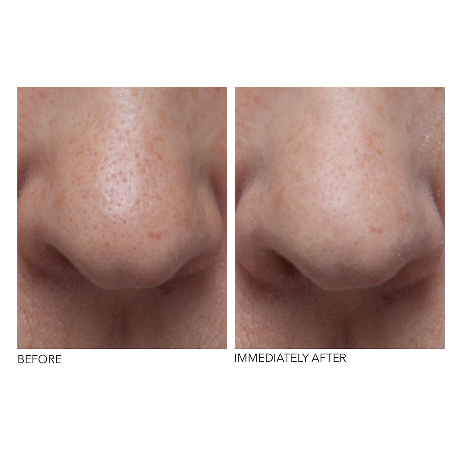 Drx Blemish Solutions™ Clarifying Mask With Colloidal Sulfur ...