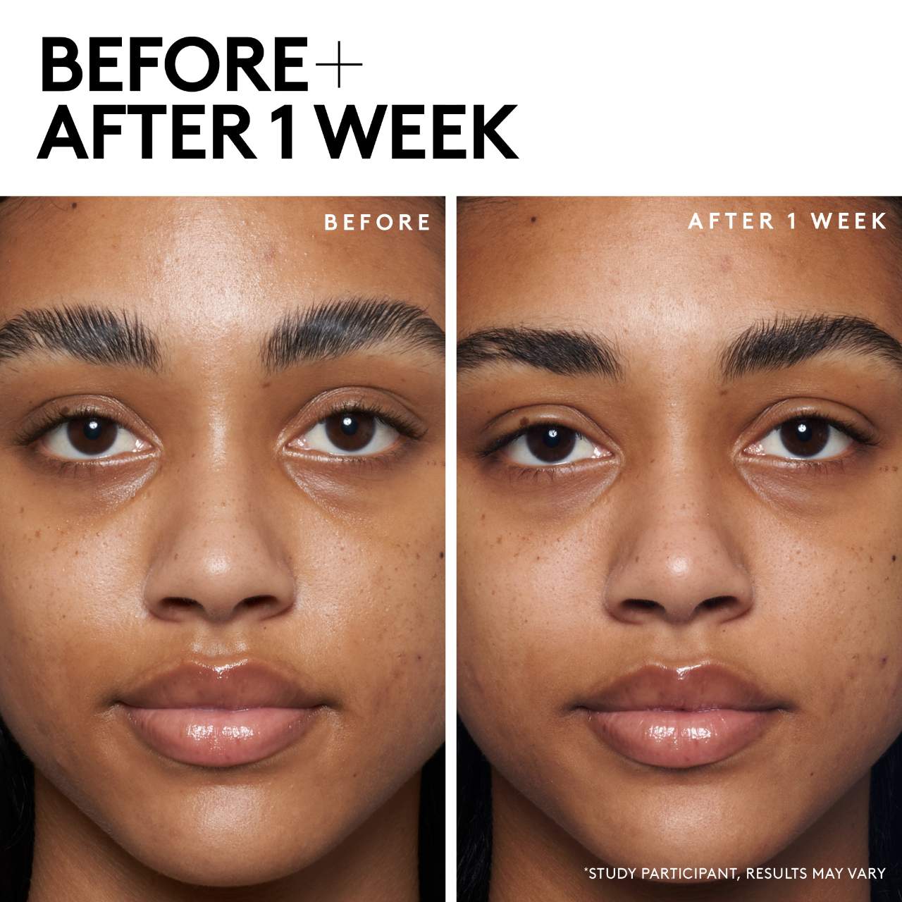 Cherry Dub Blah To Bright 5% Aha Face Mask With Salicylic Acid ...