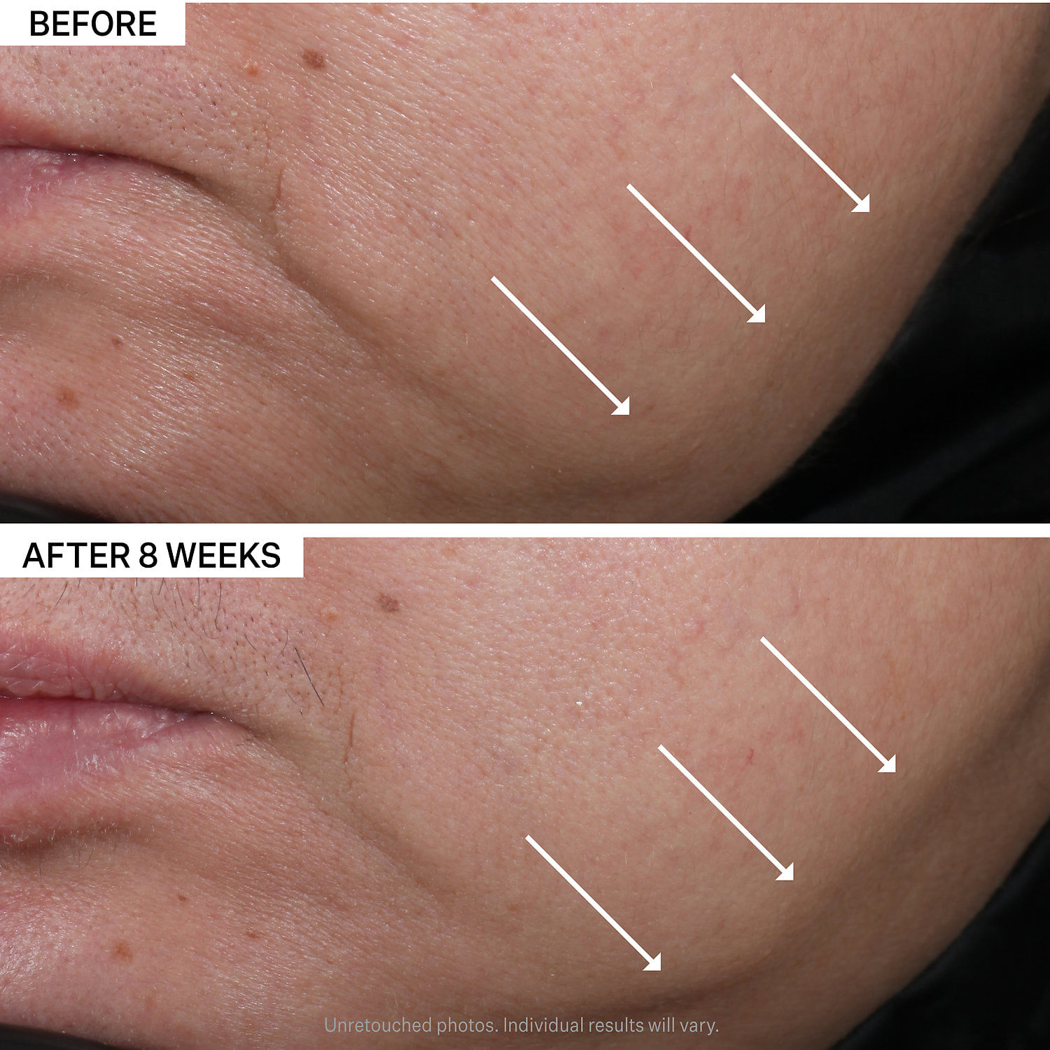 Contour Restore™ Tightening & Sculpting Moisturizing Face Cream ...