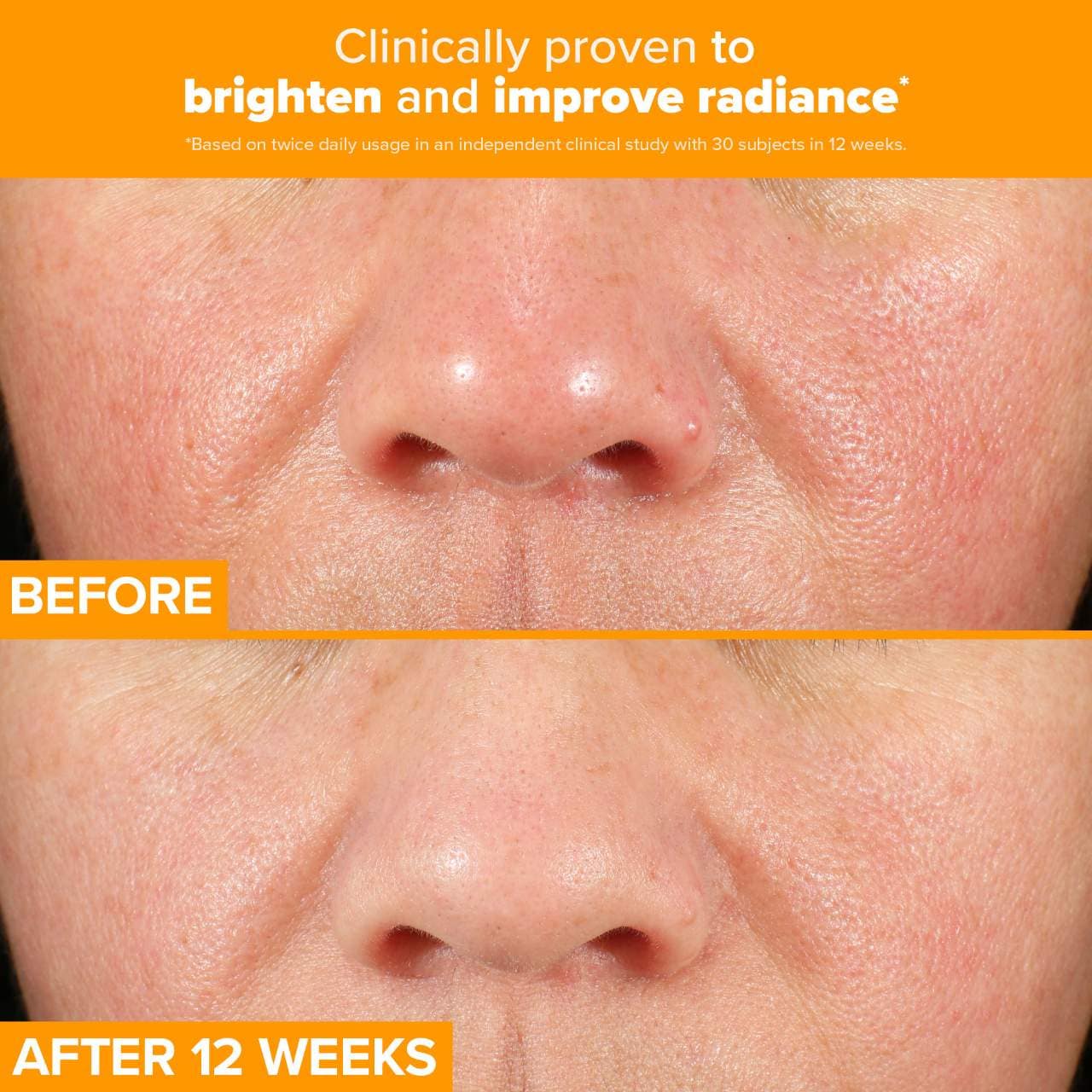 C15 Super Booster For Brightening Dullness & Uneven Tone | Cosmopolitan ...