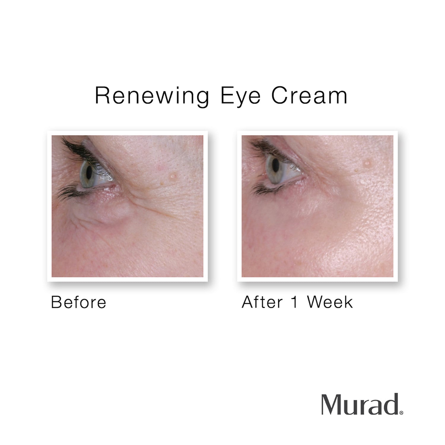 Renewing Eye Cream | Cosmopolitan Shop