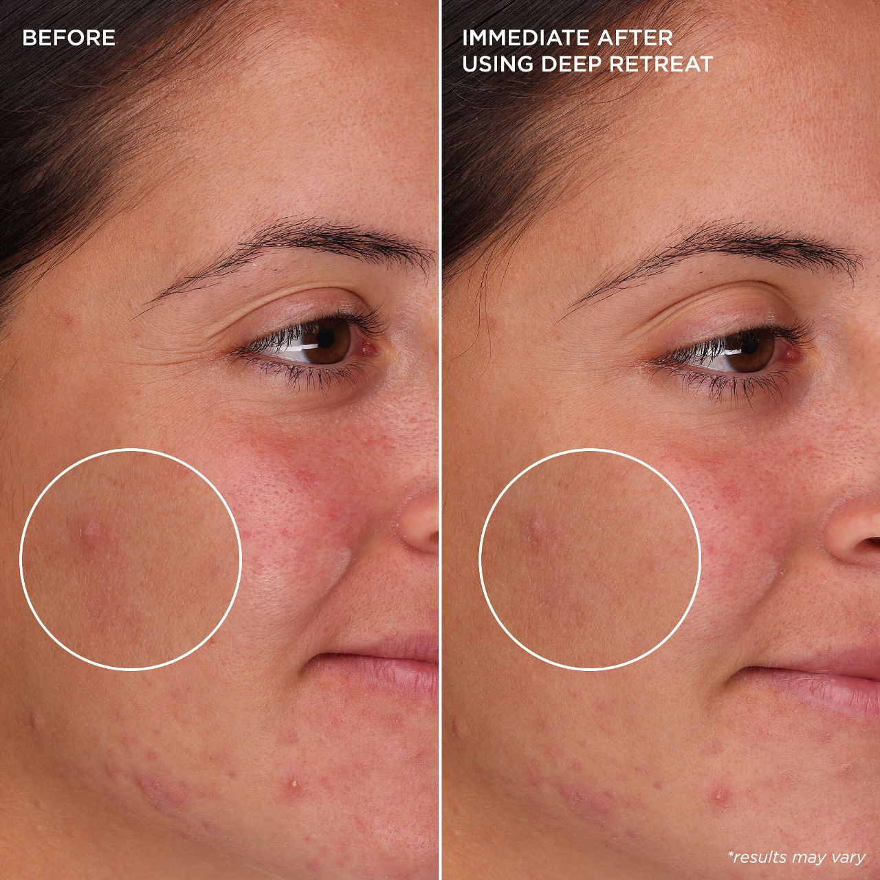 Mini The Porefessional Deep Retreat Pore-clearing Clay Mask ...